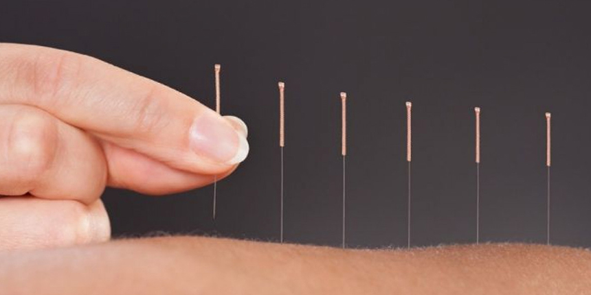 Akupunktur – Uzm. Dr. Canan Esendemir